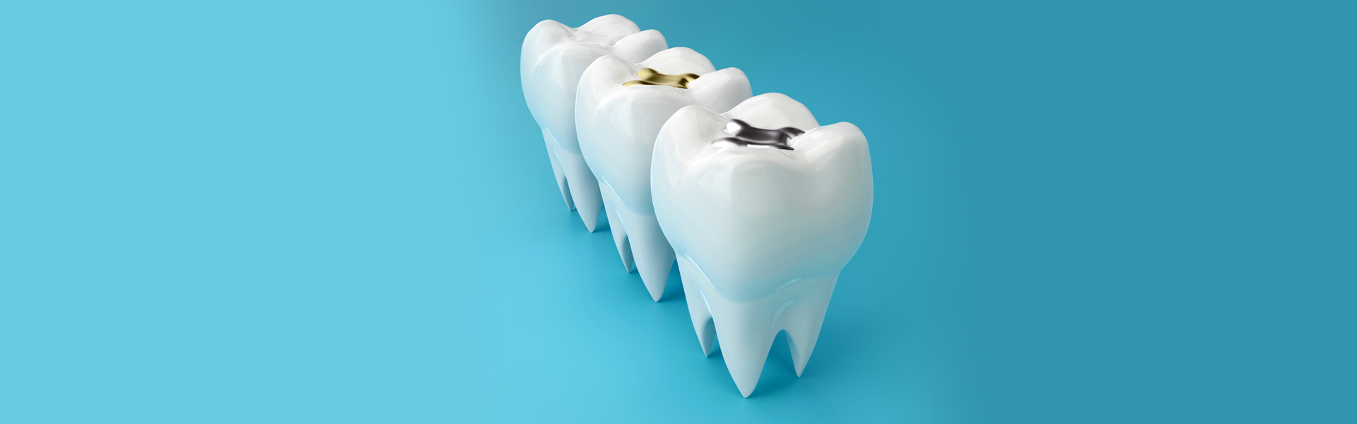 How Modern Technology Has Improved Dental Fillings